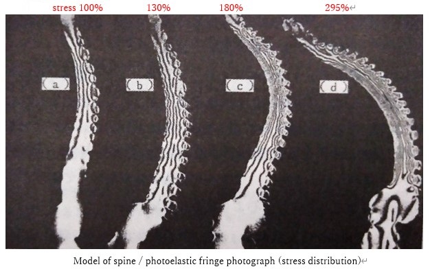 Stress on the spine (investigation by the “Polariscope using the ...